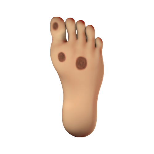 Wound Care - Texas Cardiac & Vascular Institute