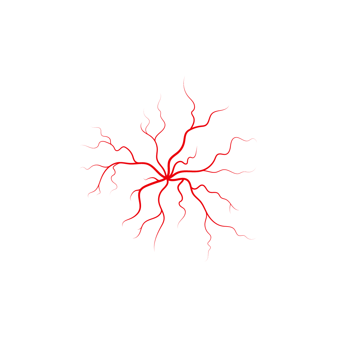 Spider Veins - Texas Cardiac & Vascular Institute